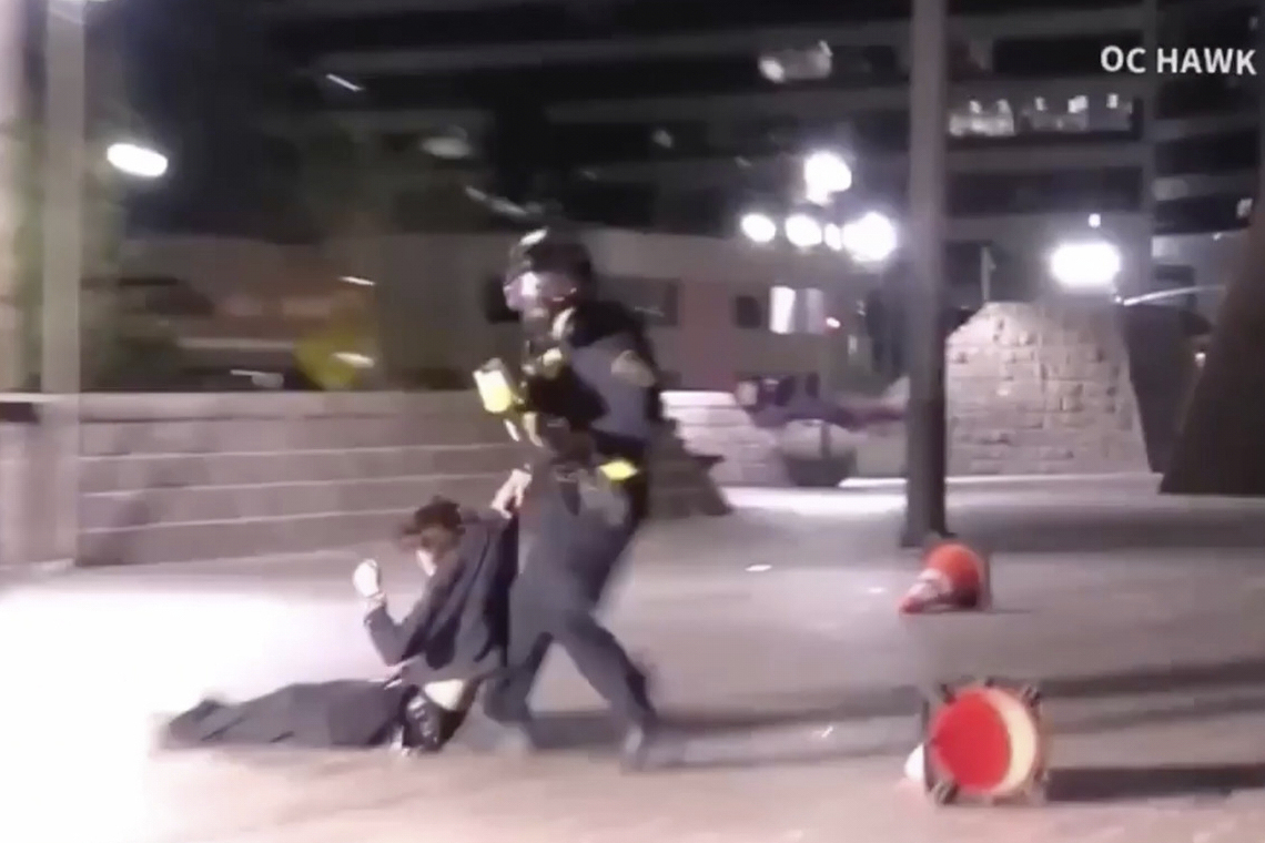 Santa Ana protester blinded in one eye after federal agent fired ...